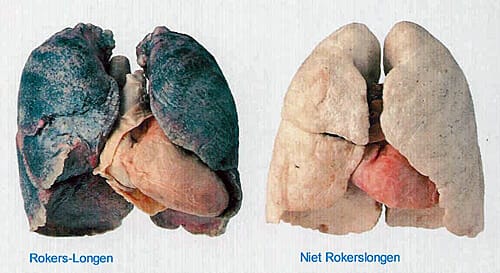 Schadelijke gevolgen van roken | Algemeen | Menselijk Lichaam