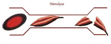 Hemolyse | Bloed / afweersysteem | Menselijk Lichaam